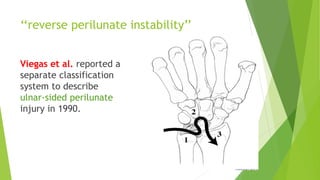 Perilunate injuries and lunate dislocations [Autosaved].pptx