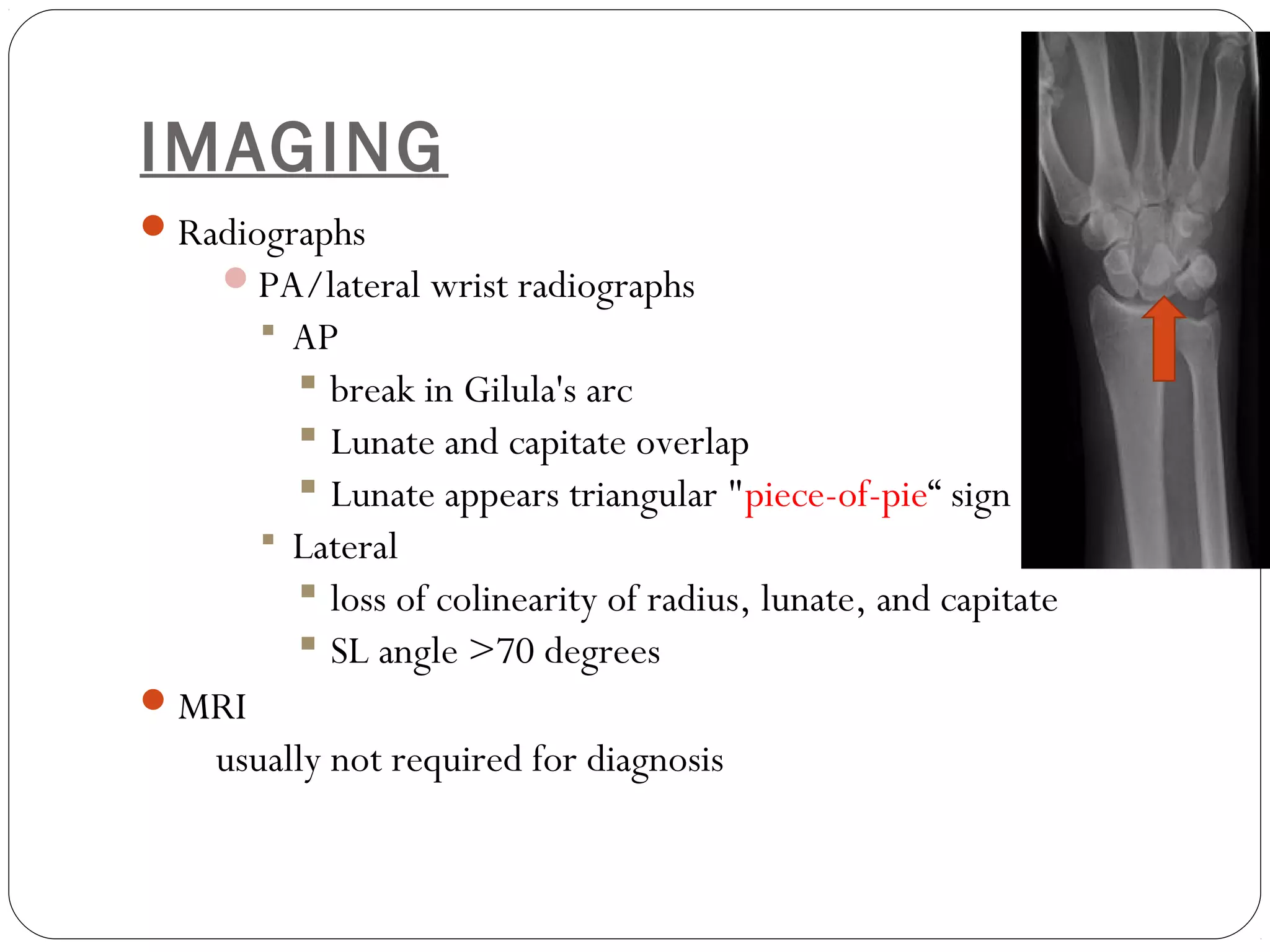 Perilunate dislocations | PPT