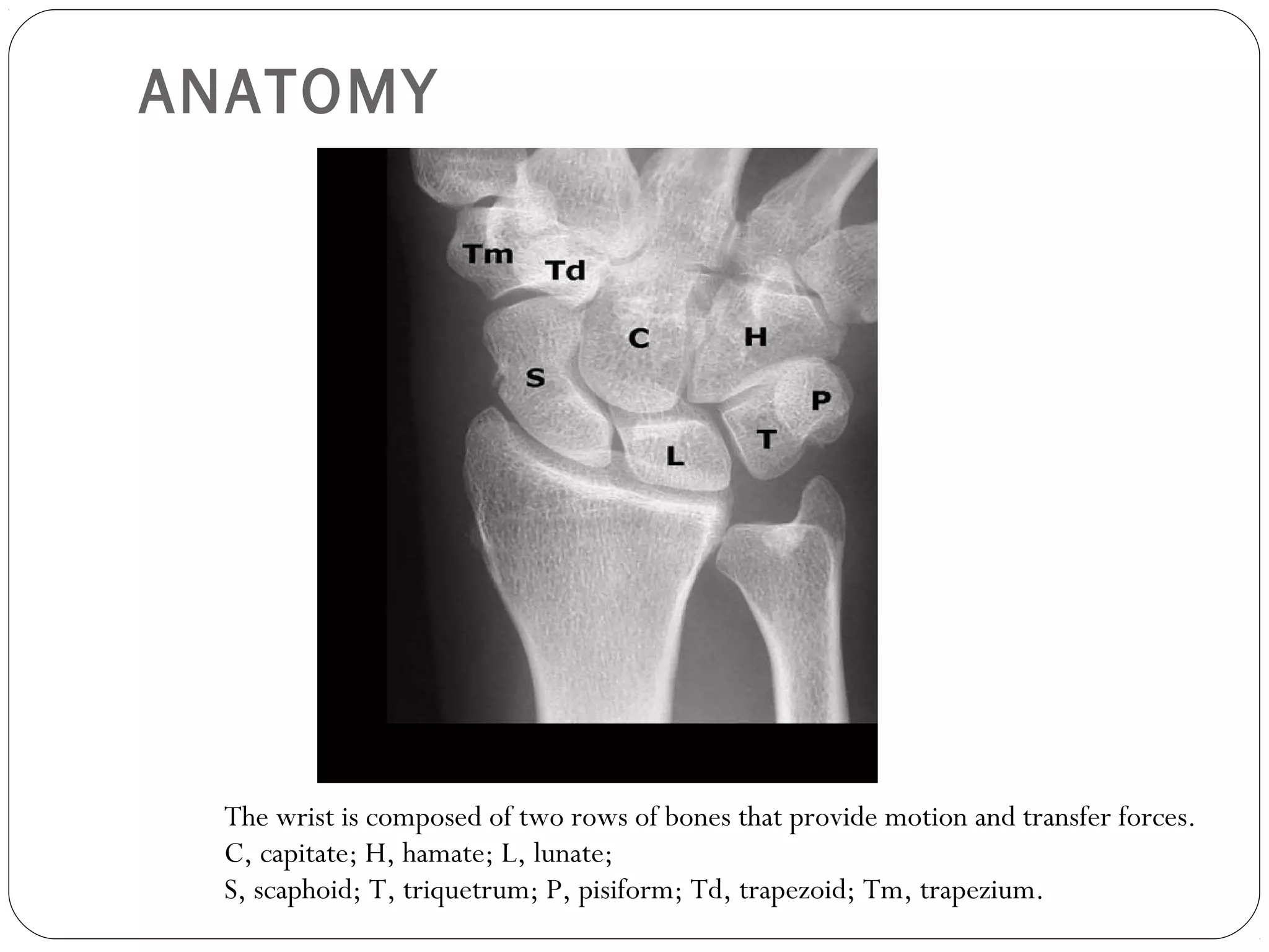 Perilunate dislocations | PPT