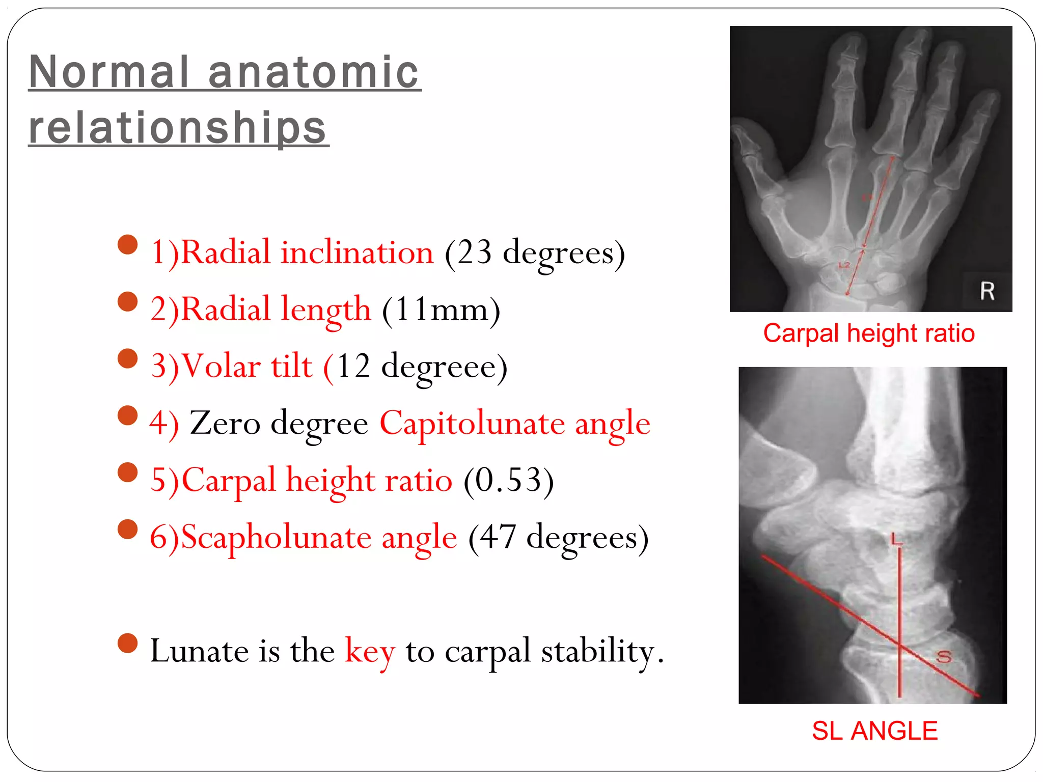 Perilunate dislocations | PPT