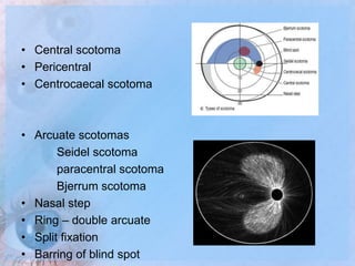 Visual Field Examination | PPTX