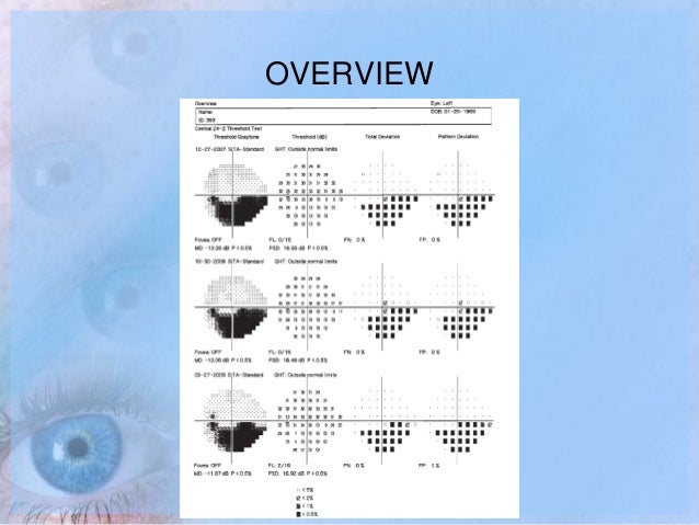 Visual Field Examination