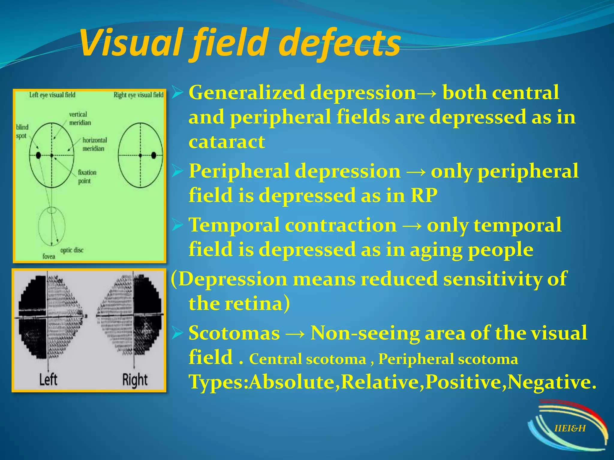 Humphrey visual field analyser (HVFA) | PPTX