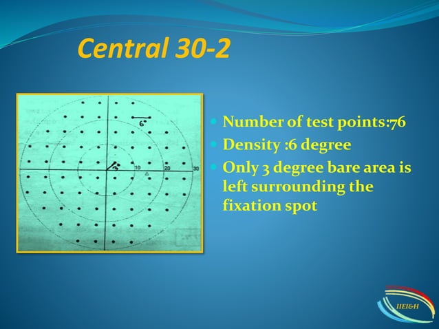 Humphrey visual field analyser (HVFA) | PPTX | 3-D Graphics | Computer ...