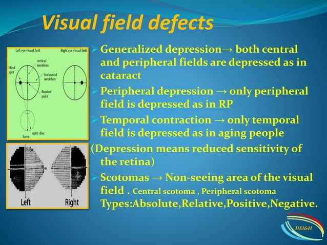 Humphrey visual field analyser (HVFA) | PPTX | 3-D Graphics | Computer ...