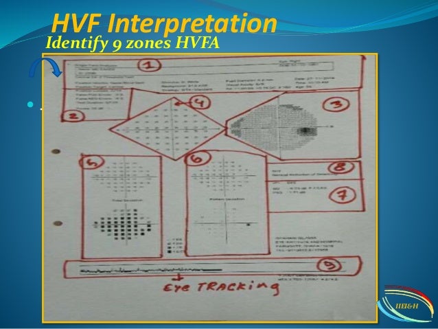 Humphrey visual field analyser (HVFA)