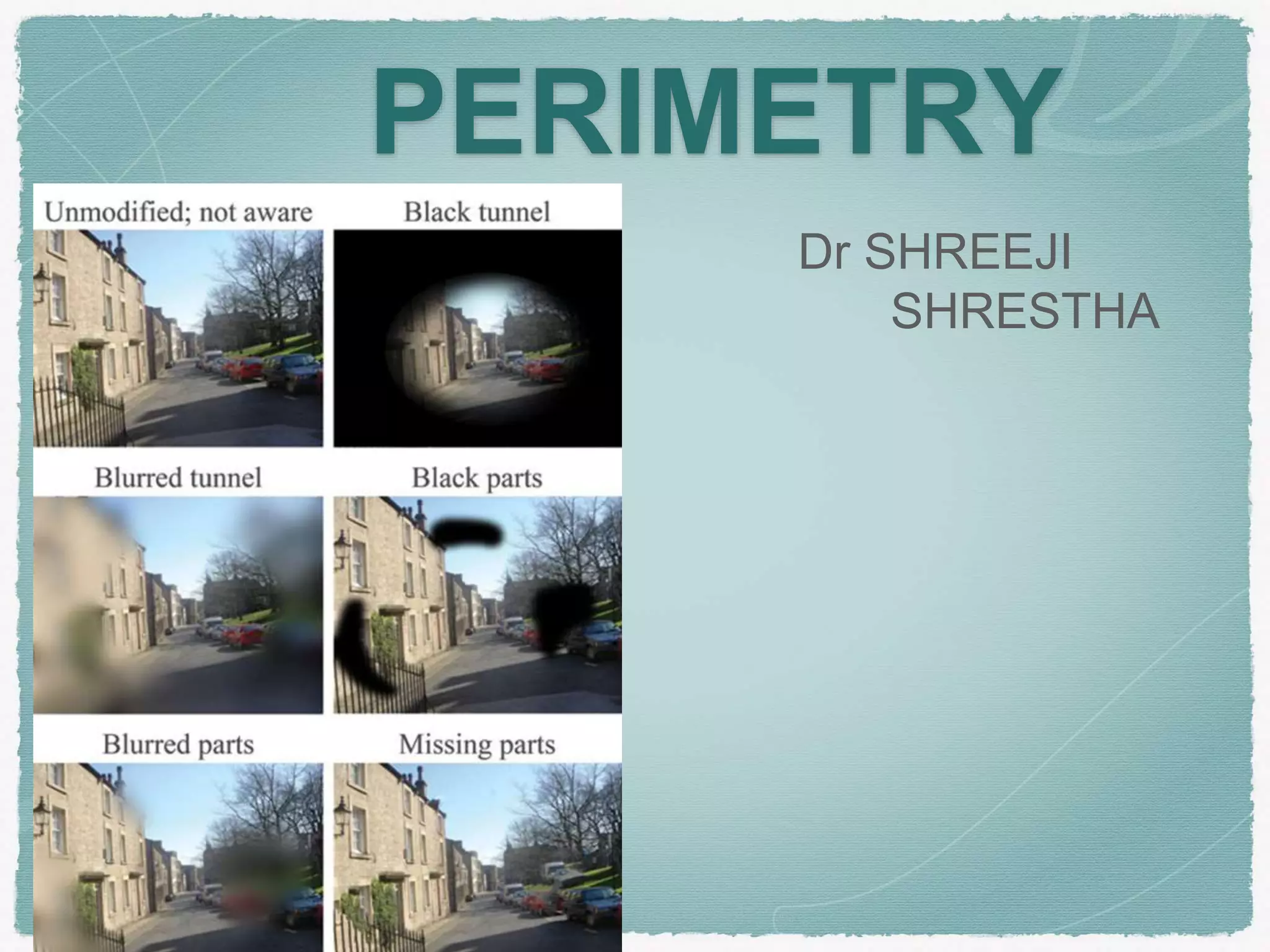 Perimetry | PPTX