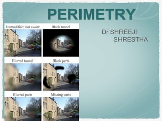 Perimetry | PPT