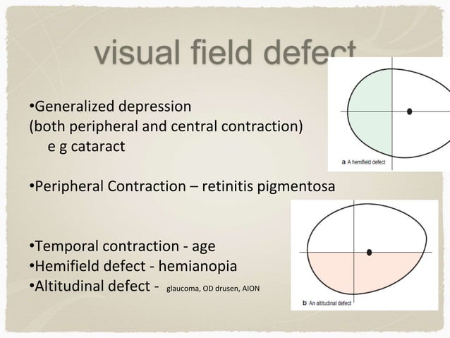 Perimetry | PPTX | Eye and Vision Conditions | Diseases and Conditions