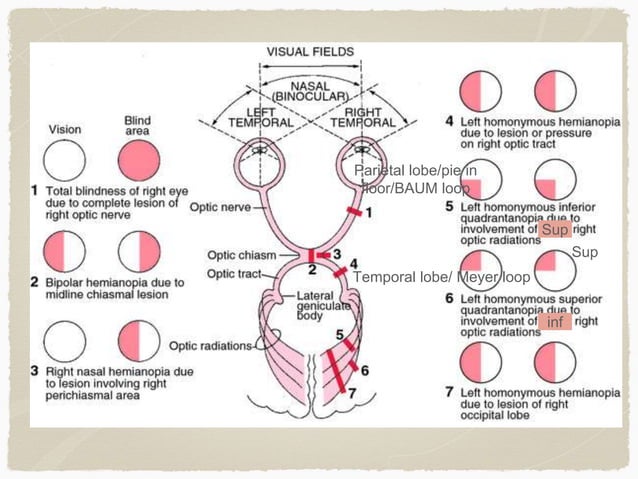 Perimetry | PPTX | Eye and Vision Conditions | Diseases and Conditions