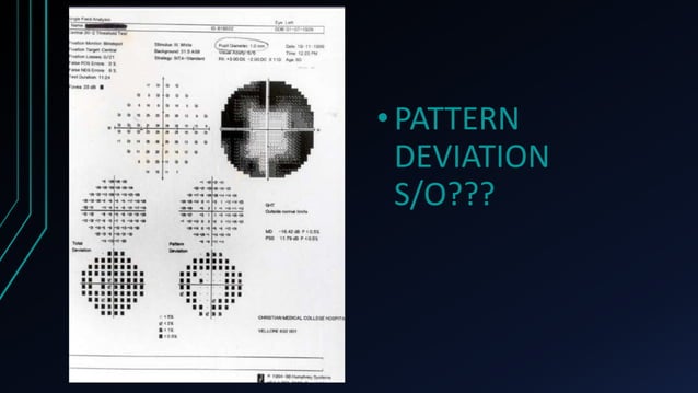 Perimetry | PPTX | Eye and Vision Conditions | Diseases and Conditions