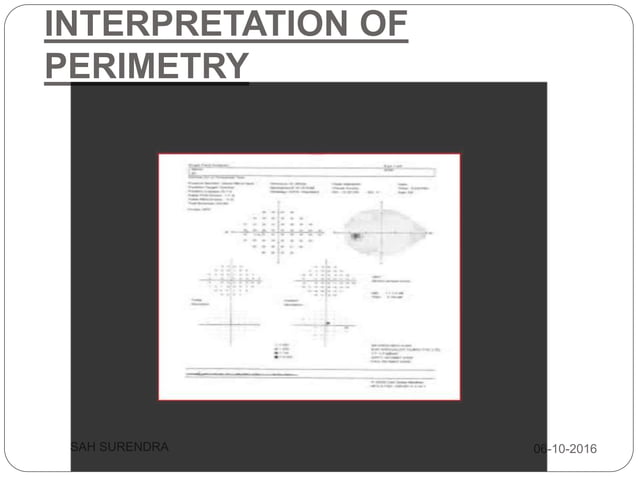 Perimetry by surendra | PPTX | Eye and Vision Conditions | Diseases and ...