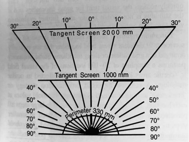 Perimetry | PPTX | Eye and Vision Conditions | Diseases and Conditions