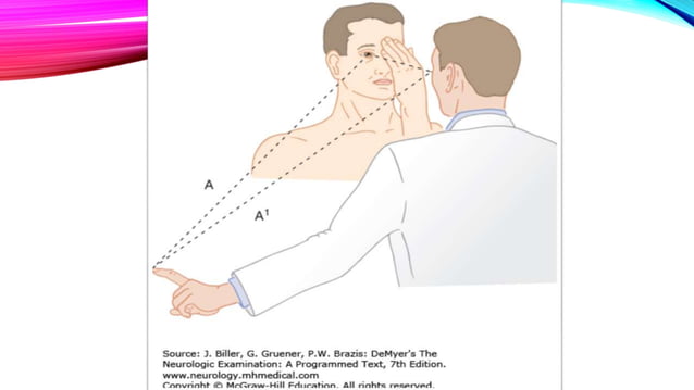Perimetry & Effects of lesions at different levels of VISUAL PATHWAY ...