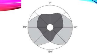 Perimetry & Effects of lesions at different levels of VISUAL PATHWAY ...
