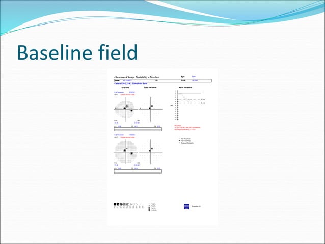 Perimetry is the technique of evaluating the Visual field . | PPT