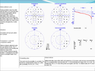 Perimetry is the technique of evaluating the Visual field . | PPT