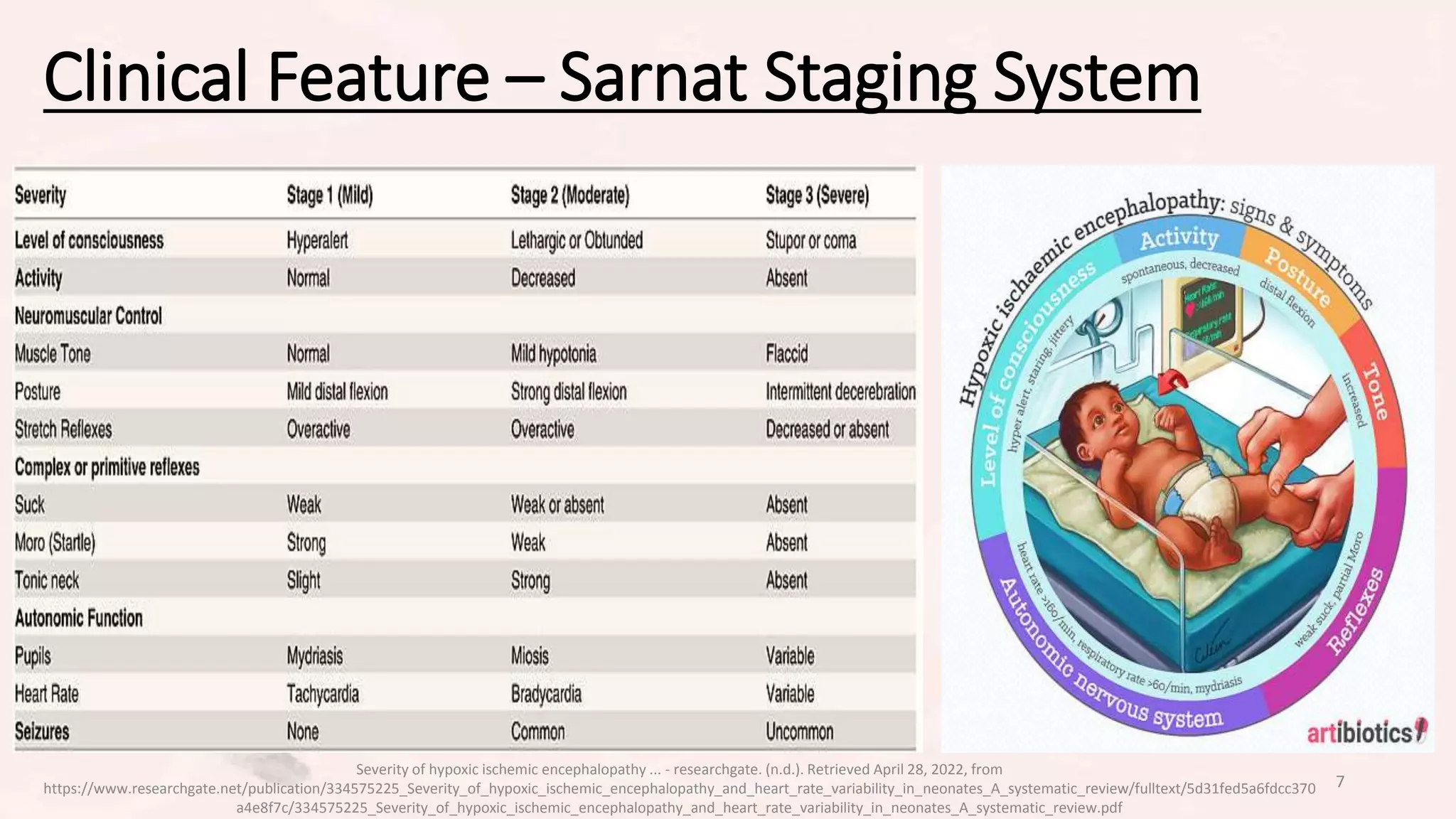 Perinatal Asphyxia & Hypoxic Ischemic Encephalopathy.pptx