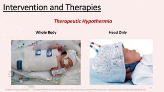 Perinatal Asphyxia & Hypoxic Ischemic Encephalopathy.pptx