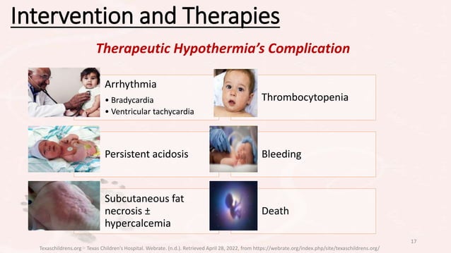 Perinatal Asphyxia & Hypoxic Ischemic Encephalopathy.pptx