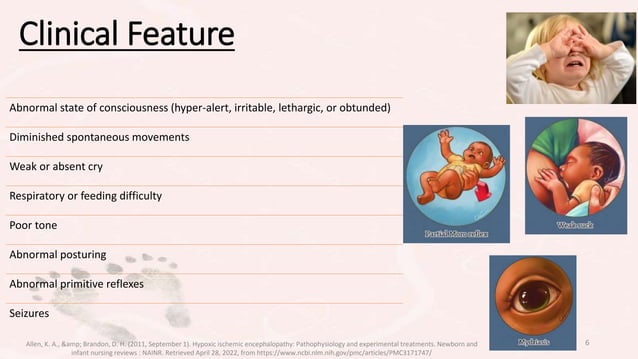 Perinatal Asphyxia & Hypoxic Ischemic Encephalopathy.pptx