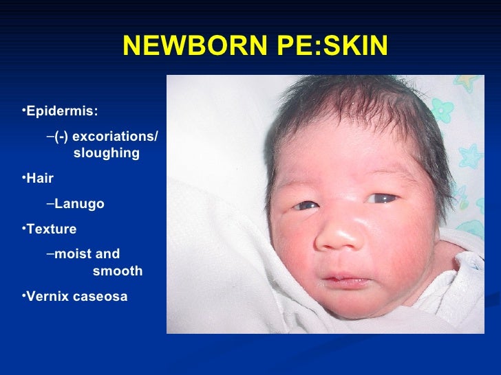 Perinatal history, normal newborn