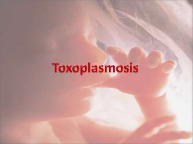 Perinatal infections- Diagnosis & Management - Dr Padmesh - Neonatology ...