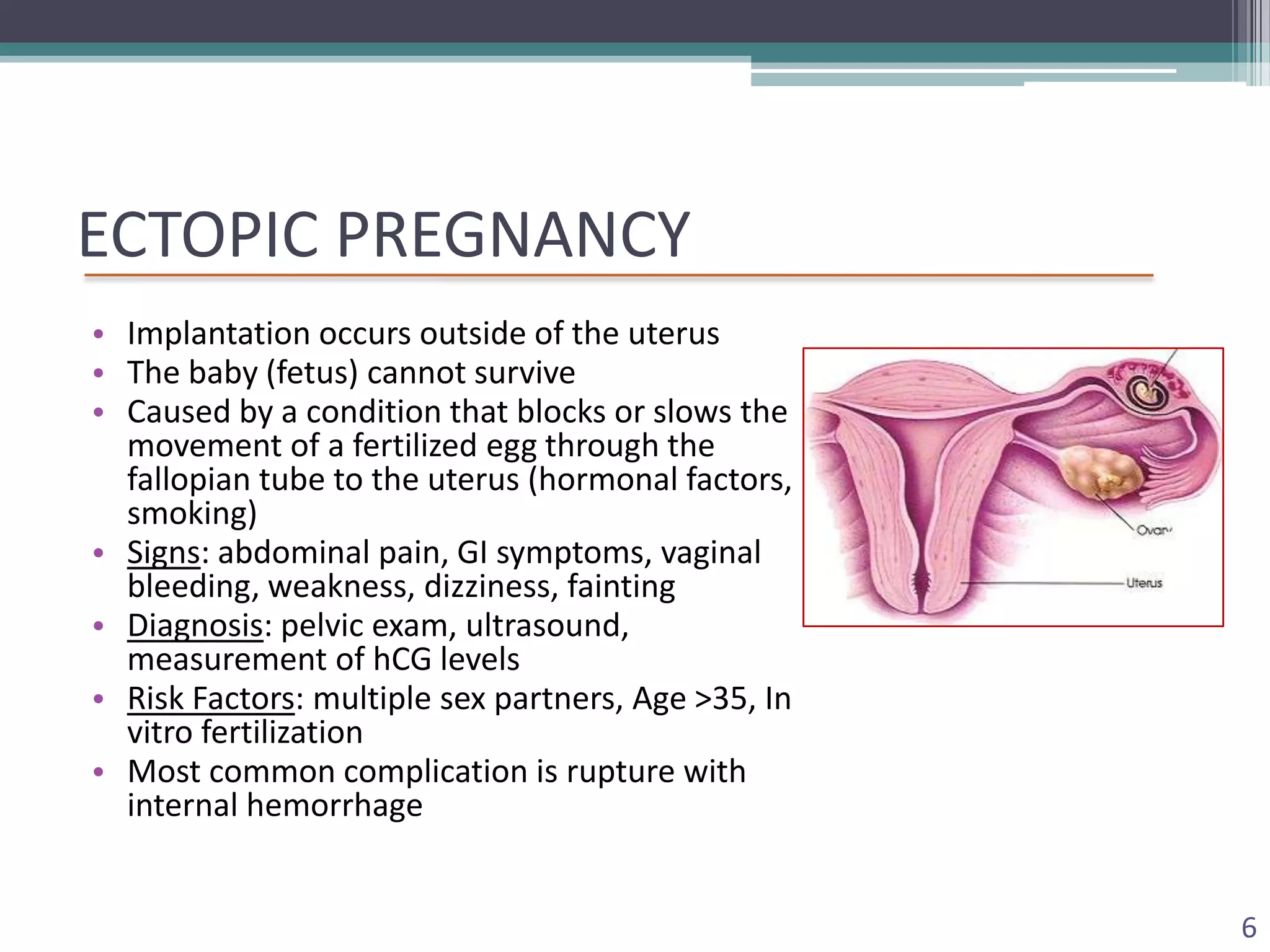 Perinatal Loss And Grief | PPTX