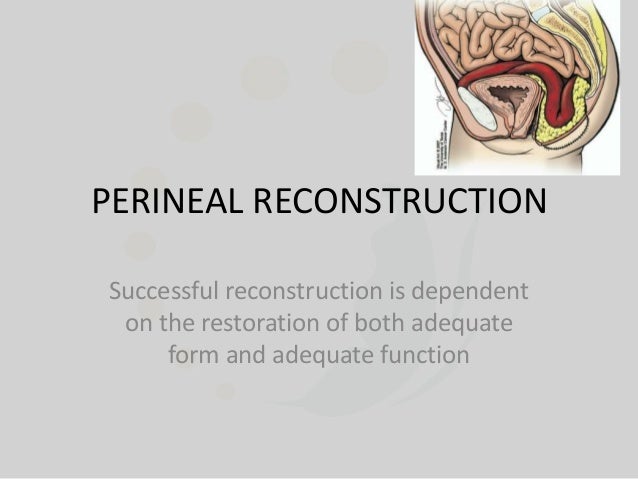Perineal reconstruction