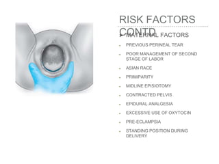 RISK FACTORS,EVALUATION AND MANAGEMENT OF PERINEAL TEARS | PPTX