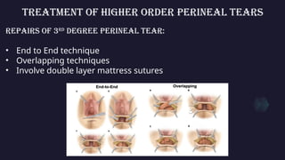 PERINEAL BODY PPT ANATOMY MBBS 1ST YEAR | PPTX
