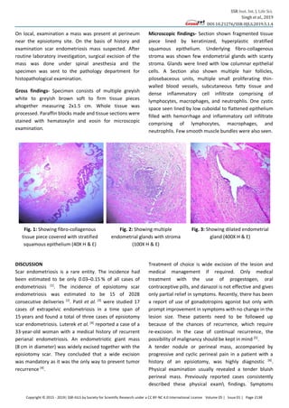 Perineal_Endometriosis_An_Episiotomy_Scar.pdf