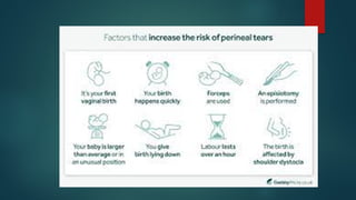 perineal tear description , types , repair and treatment | PPTX