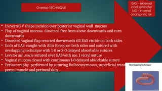 perineal tear description , types , repair and treatment | PPTX