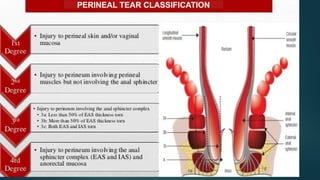 perineal tear description , types , repair and treatment | PPTX