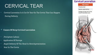 perineal tear description , types , repair and treatment | PPTX