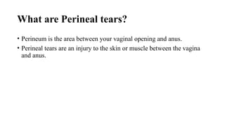 Perineal Tears PowerPoint Presentation.pptx