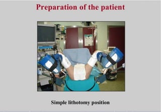 Perineal urethrostomy | PDF