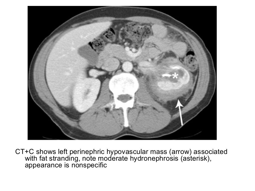 Diagnostic Imaging of Perinephric Space
