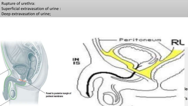 Perineum & external genitalia | PPTX | Obscenity and Profanity | Sensitive Topics