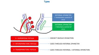 PERINEUM PRESENTATION.pptx
