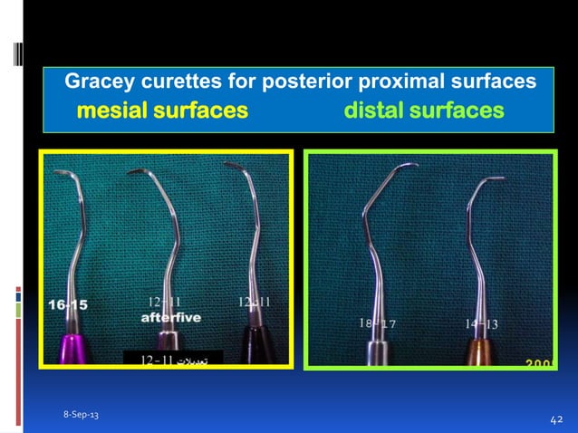 Perio. instrumentation | PPTX