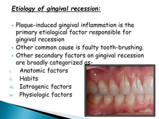 Gingival inflammation & clinical features of gingivitis | PPTX