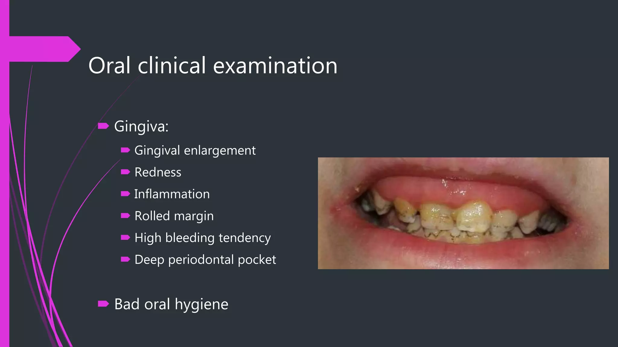 Case presentation in Oral Diagnosis and Periodontology | PPTX