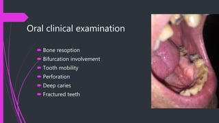 Case presentation in Oral Diagnosis and Periodontology | PPTX