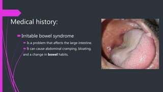 Case presentation in Oral Diagnosis and Periodontology | PPTX