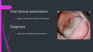 Case presentation in Oral Diagnosis and Periodontology | PPTX