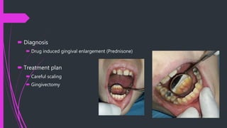 Case presentation in Oral Diagnosis and Periodontology | PPTX