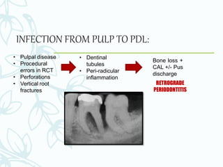 perio-endo.pptx