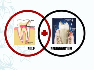 perio-endo.pptx
